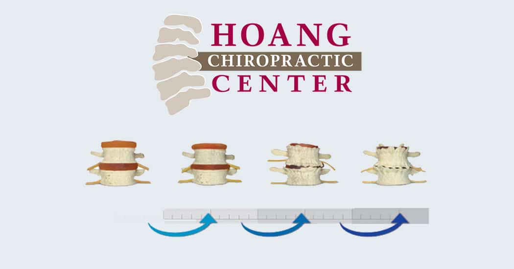 Spinal Degeneration Phases - Hoangchiro
